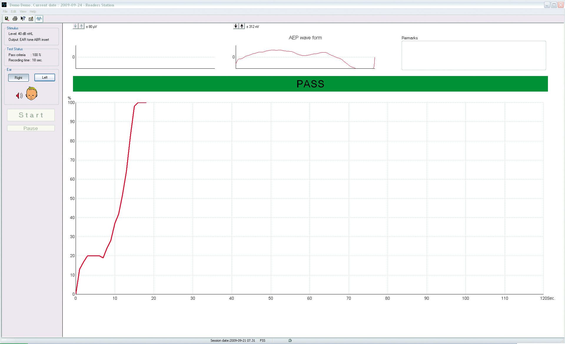 Eclipse | Evoked potentials device | Interacoustics